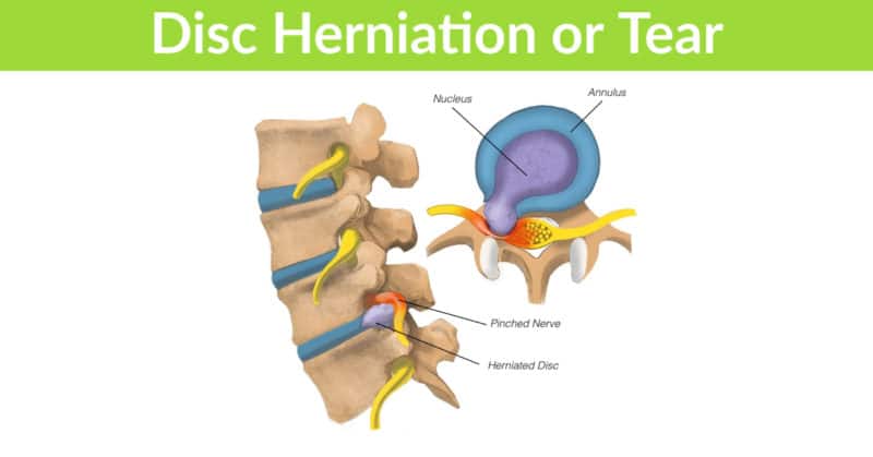The 5 Most Common Spine Dysfunctions | What to Know | Austin Chiropractor