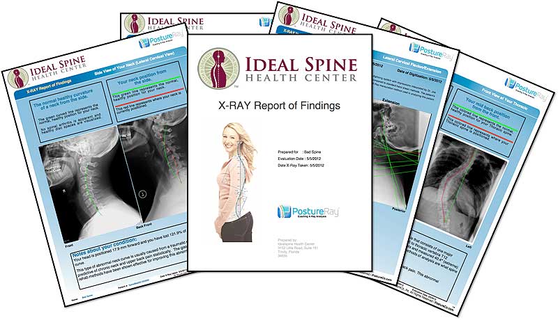 PostureRay-Reports_2013_web3 | Family Health Chiropractic