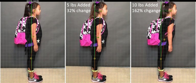 Back to School is Literally a Pain in the Neck! | Family Health ...