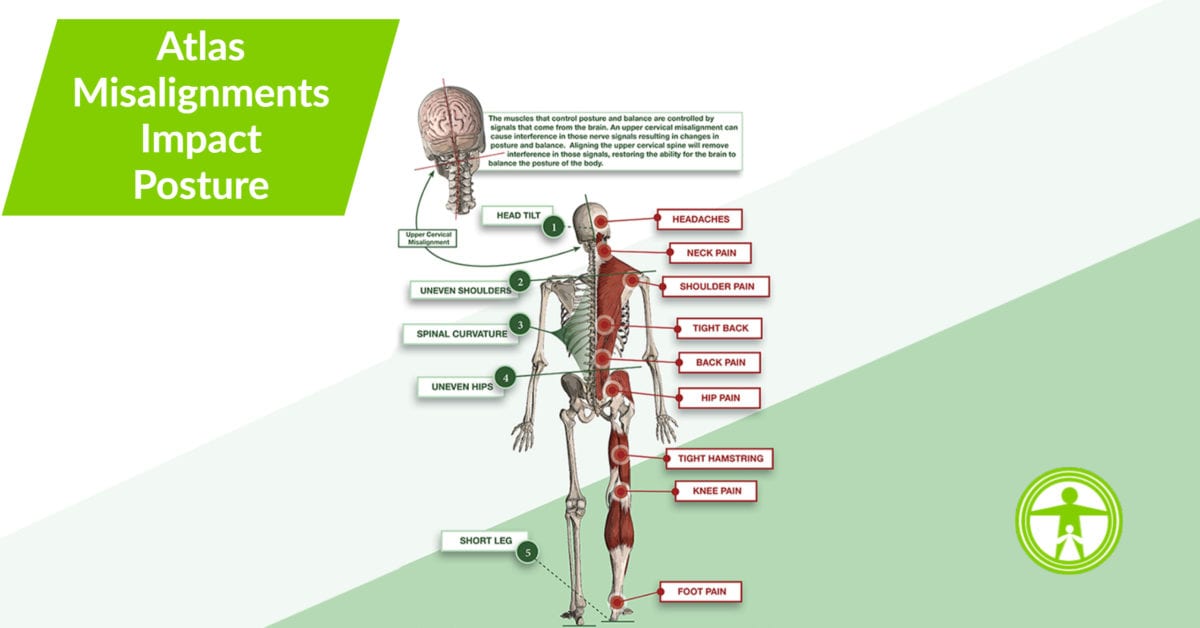 What is The Atlas Bone? | Family Health Chiropractic